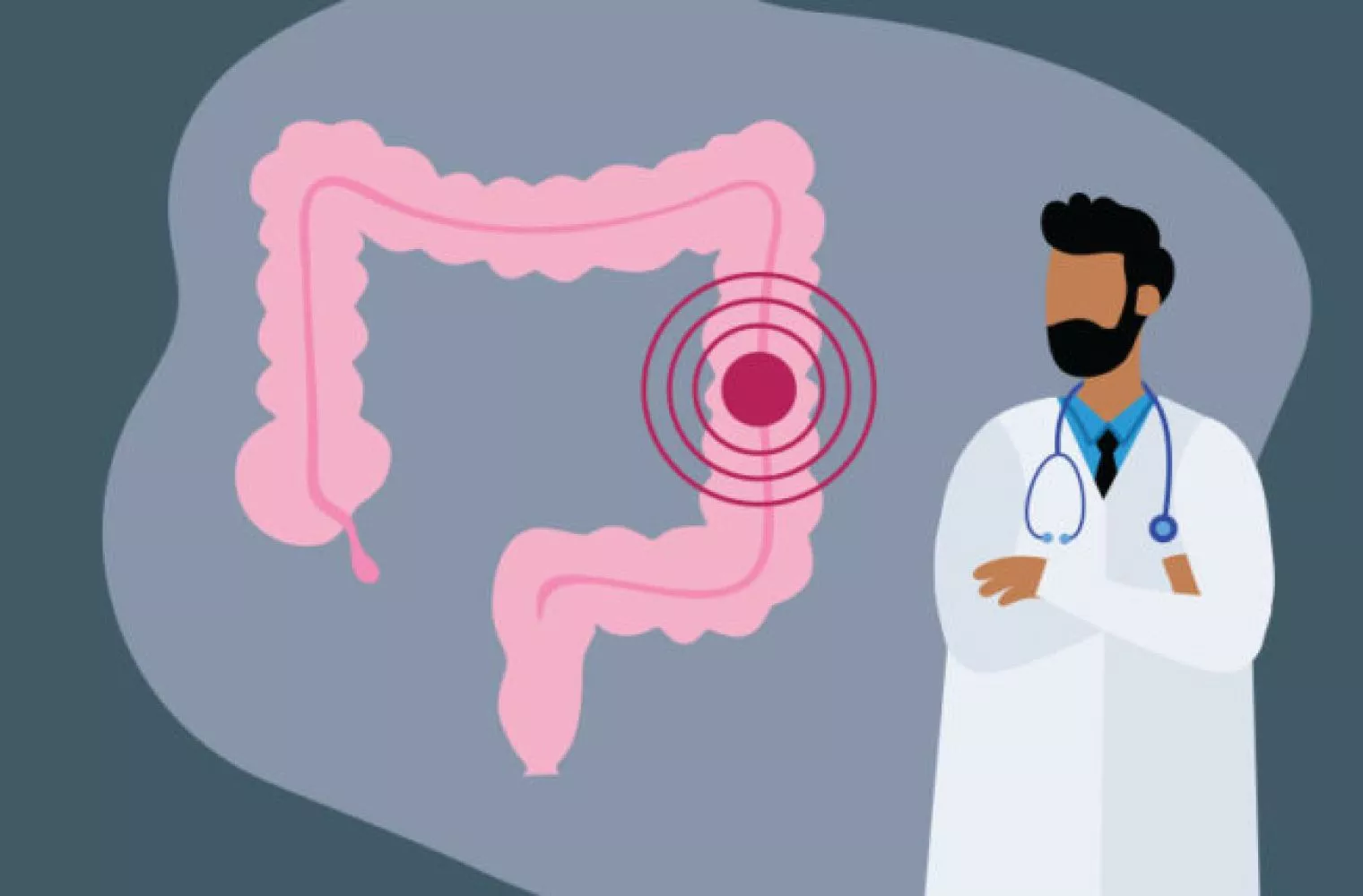 Mengenal Kanker Kolorektal: Apa Saja Faktor Resiko dan Bagaimana ...